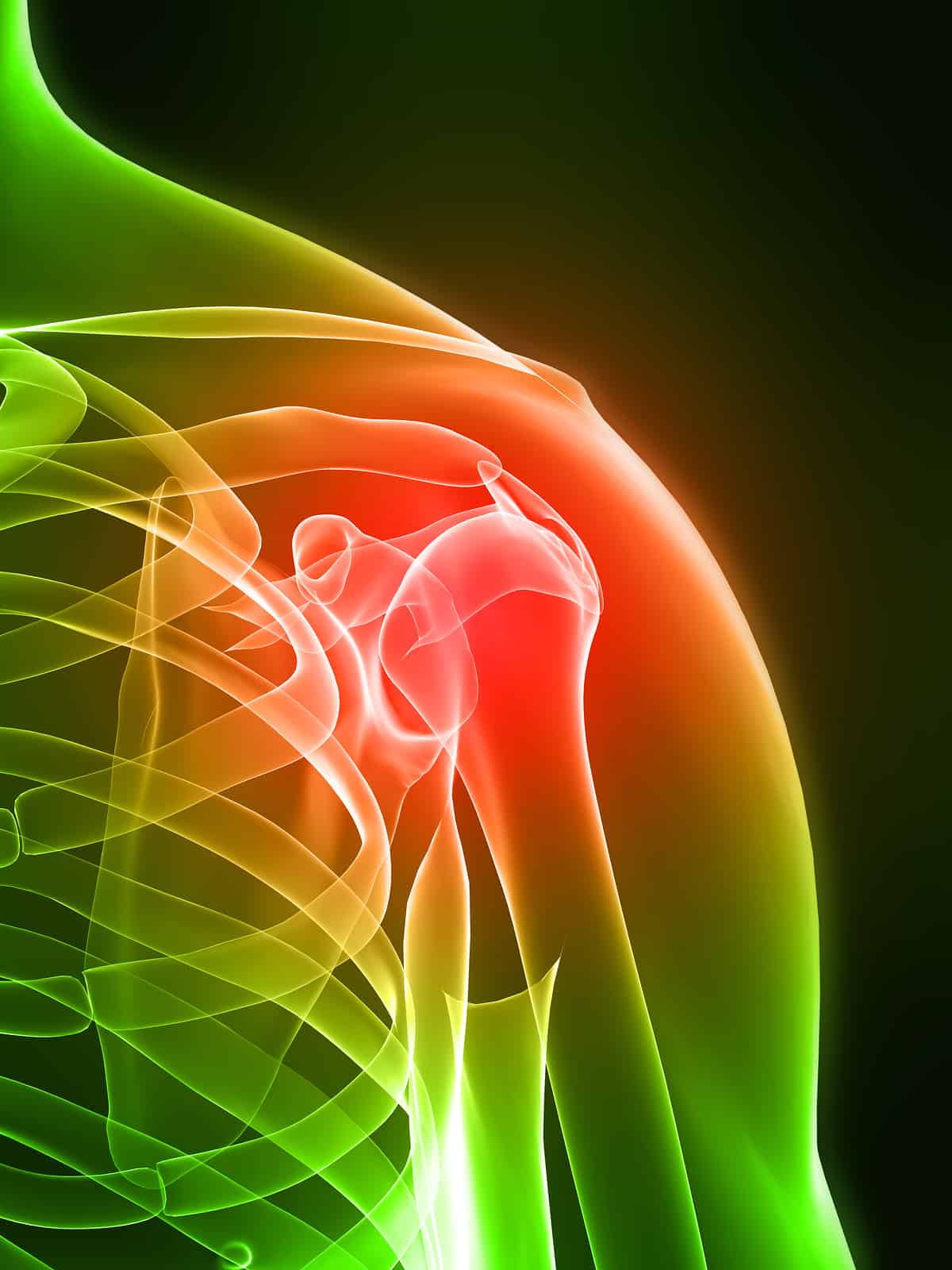 Rotator Cuff Injuries And Long-Term Disability | Ortiz Law Firm