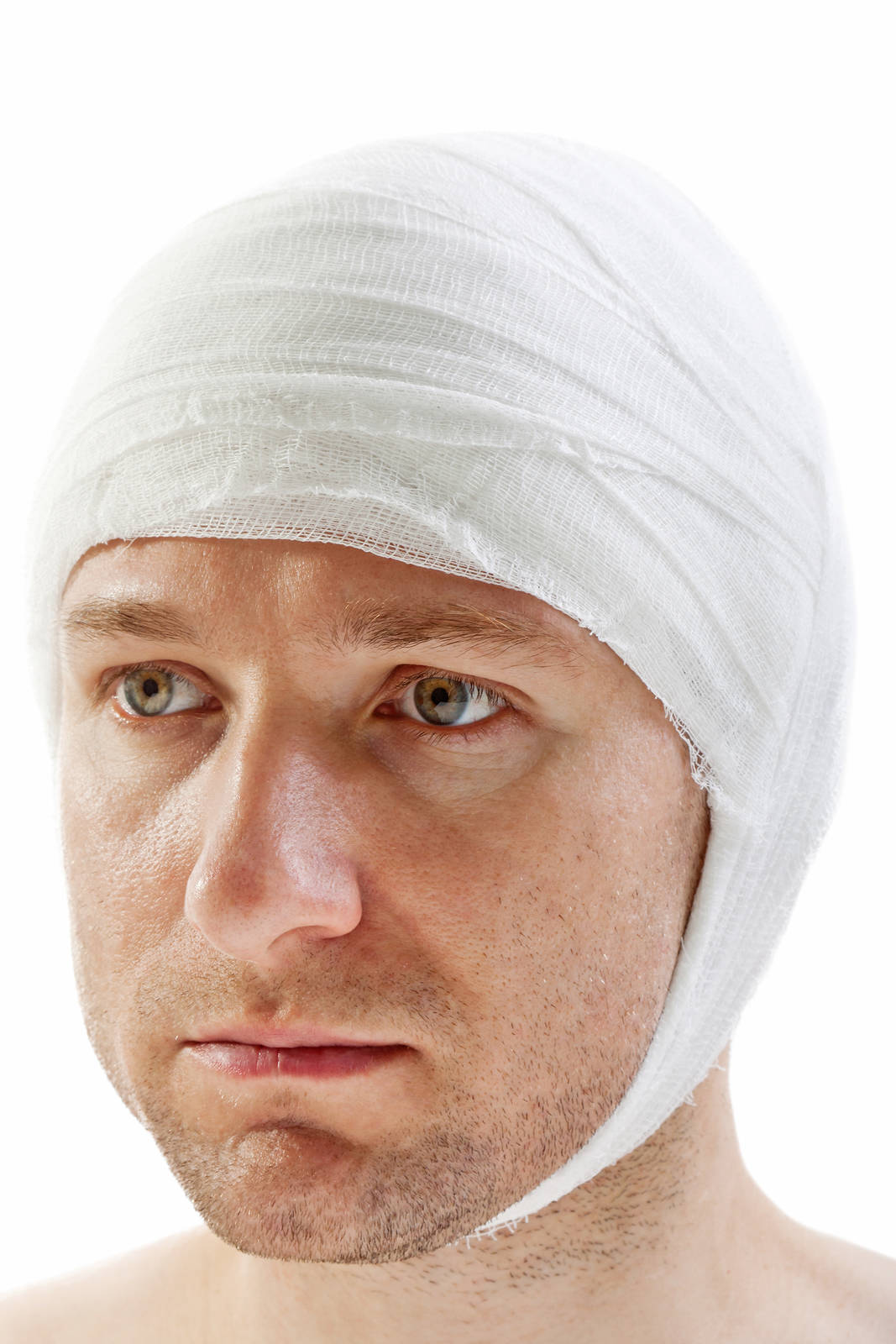 Traumatic Brain Injury (TBI) and Long Term Disability Claims