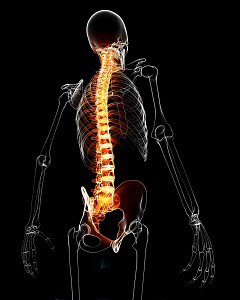 Disability Claims for Lumbar Spinal Stenosis