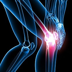 Knee Disorders and Long-Term Disability | Ortiz Law Firm